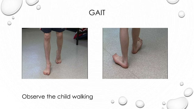 Approach to joint pain in child | PPTX | Bone and Joint Conditions ...