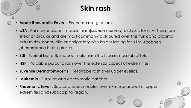 Approach to joint pain in child