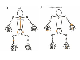 approach to joint pain patients and approach | PPTX