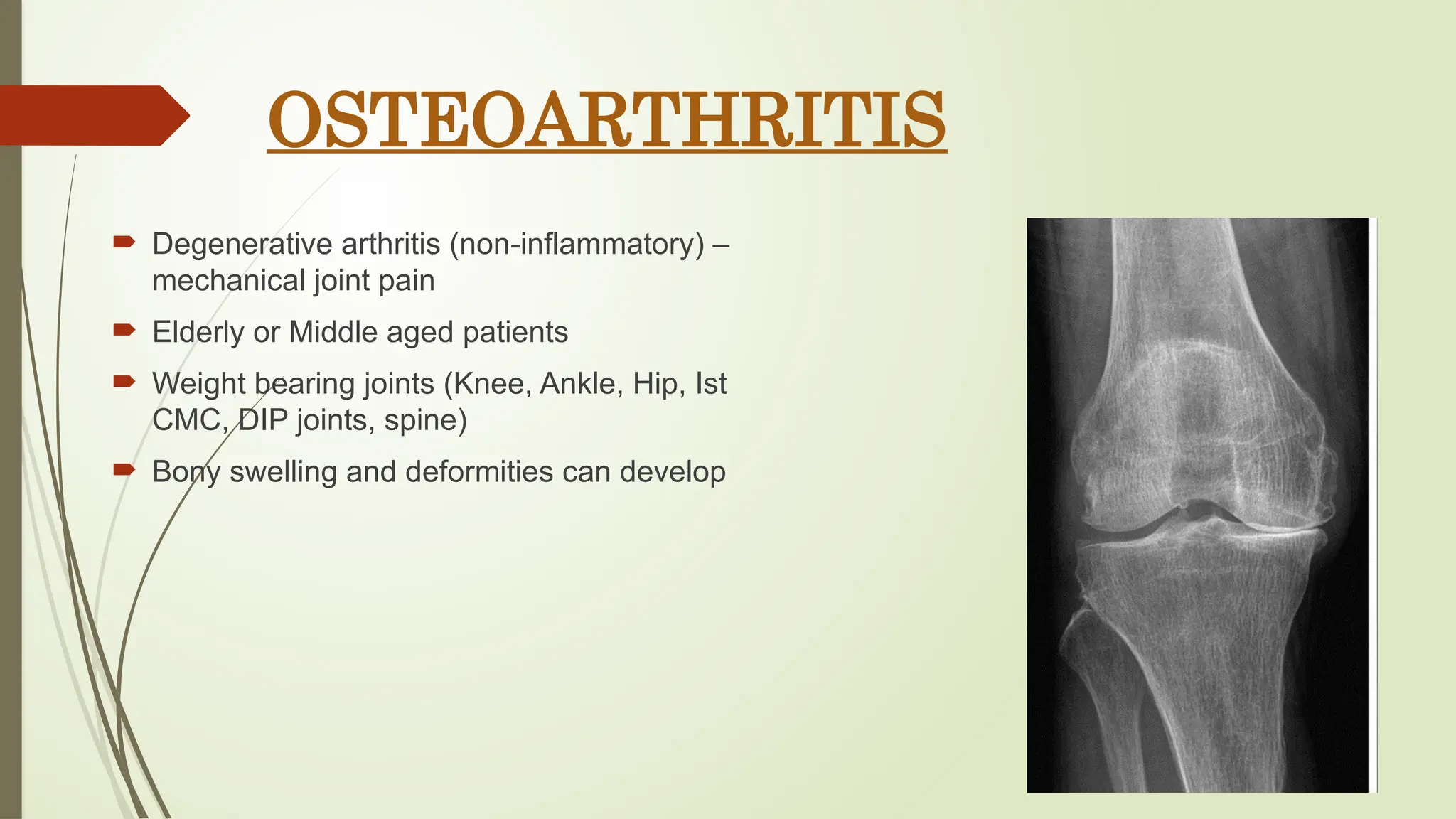 APPROACH TO JOINT PAIN AND ARTHRITIS.pptx