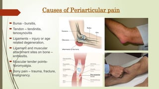 APPROACH TO JOINT PAIN AND ARTHRITIS.pptx