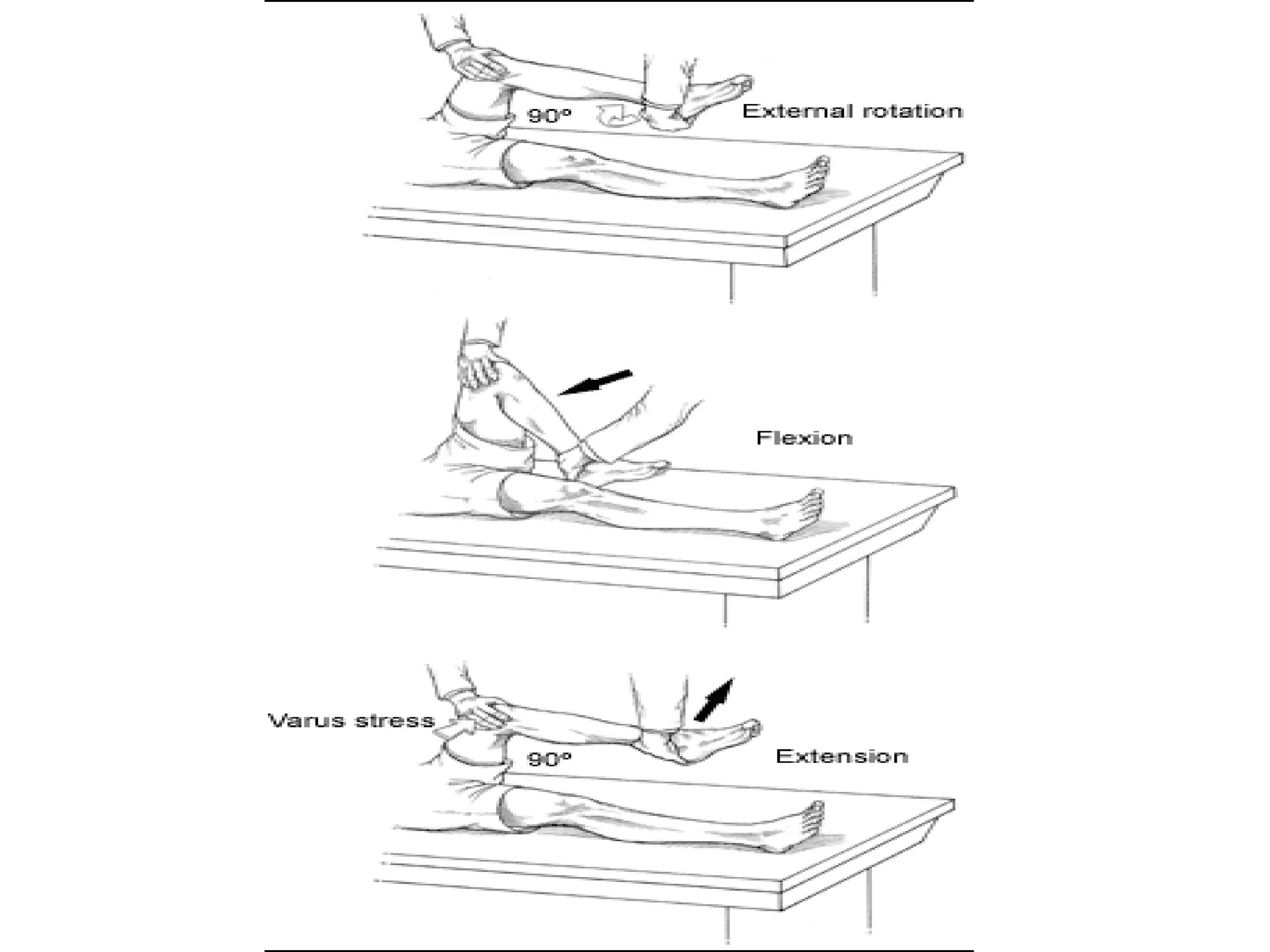 Approach to knee pain | PPT