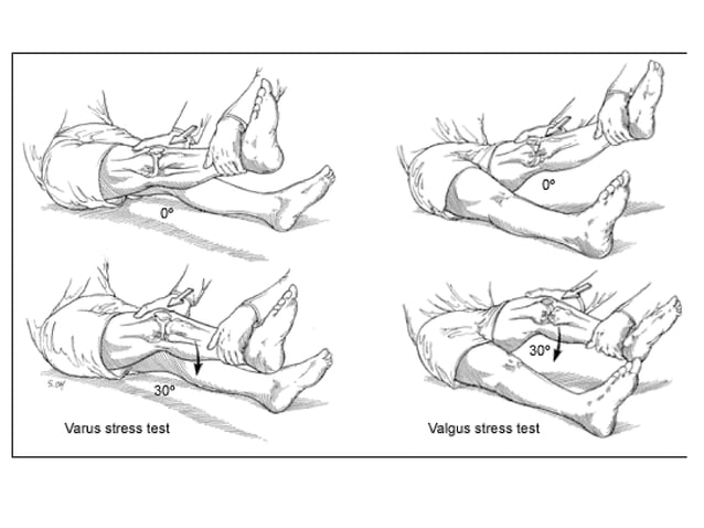 Approach to knee pain | PPT