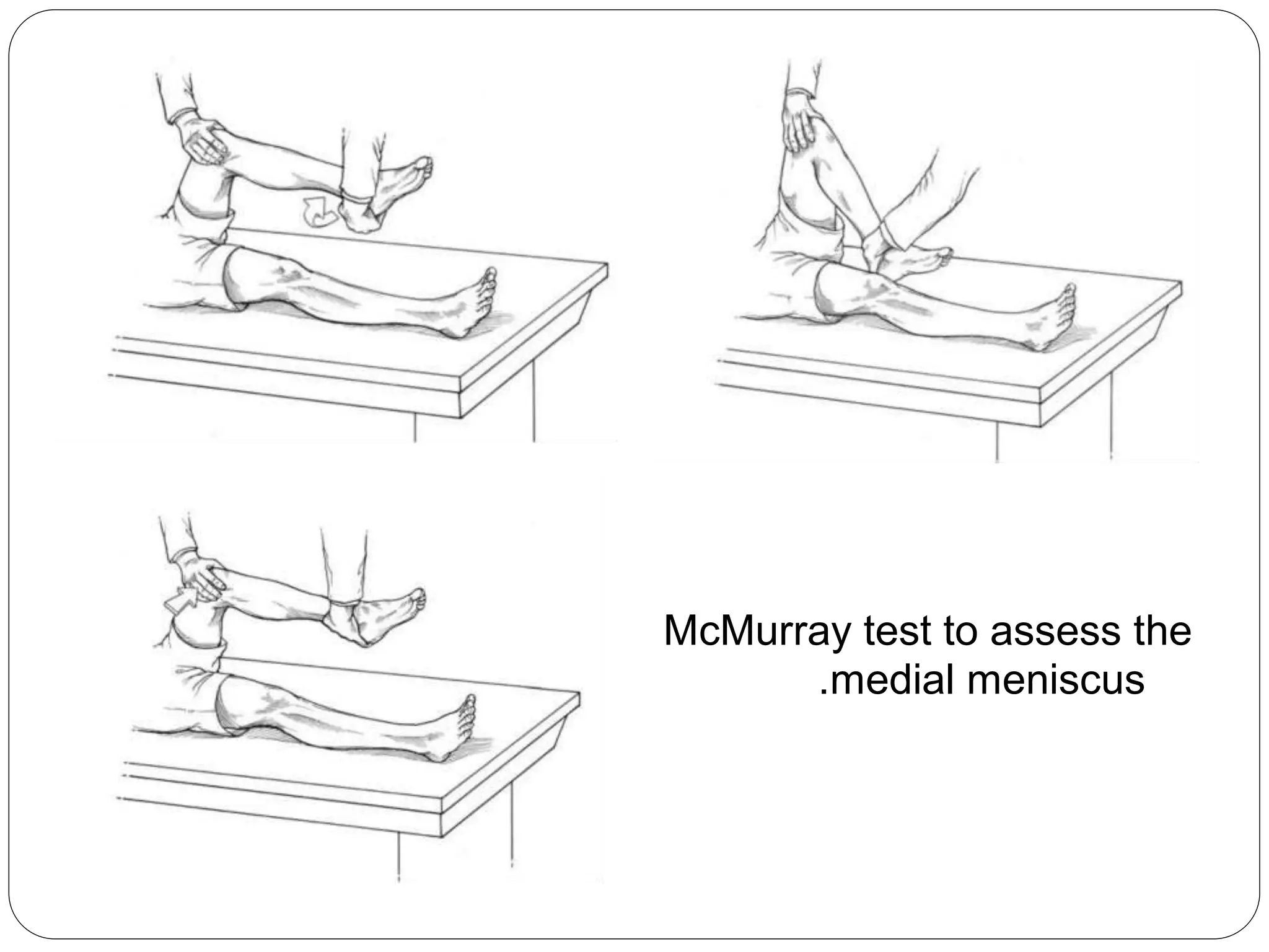 approach to knee pain 2.pptx