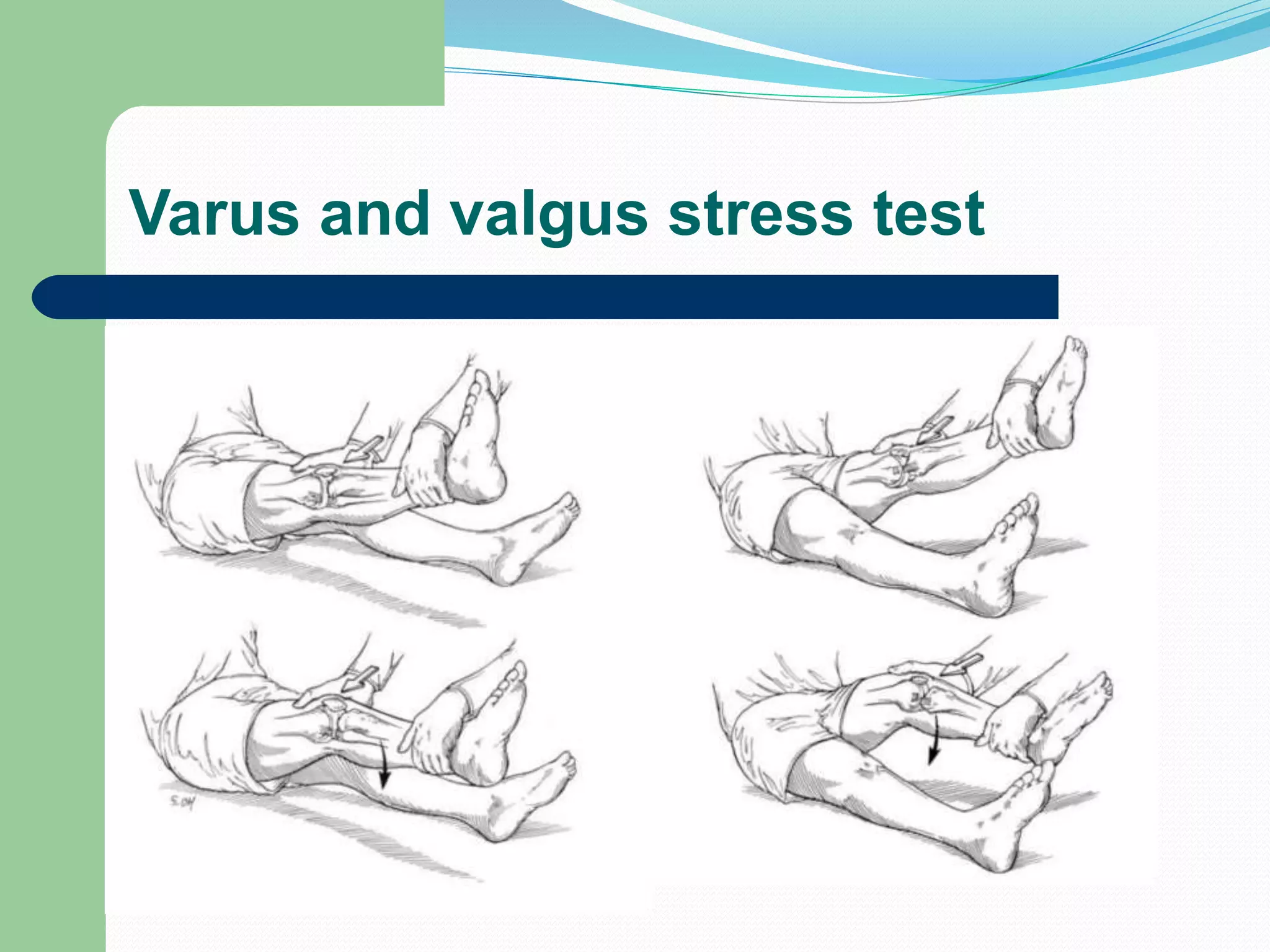 approach to knee pain 2.pptx