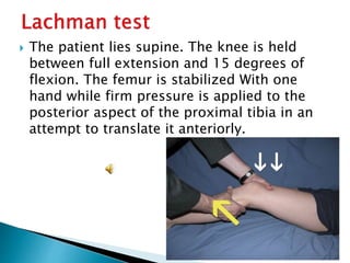approach to knee pain 2.pptx