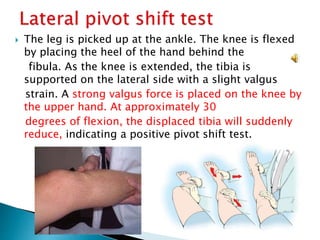 Lateral Pivot Shift Test Knee