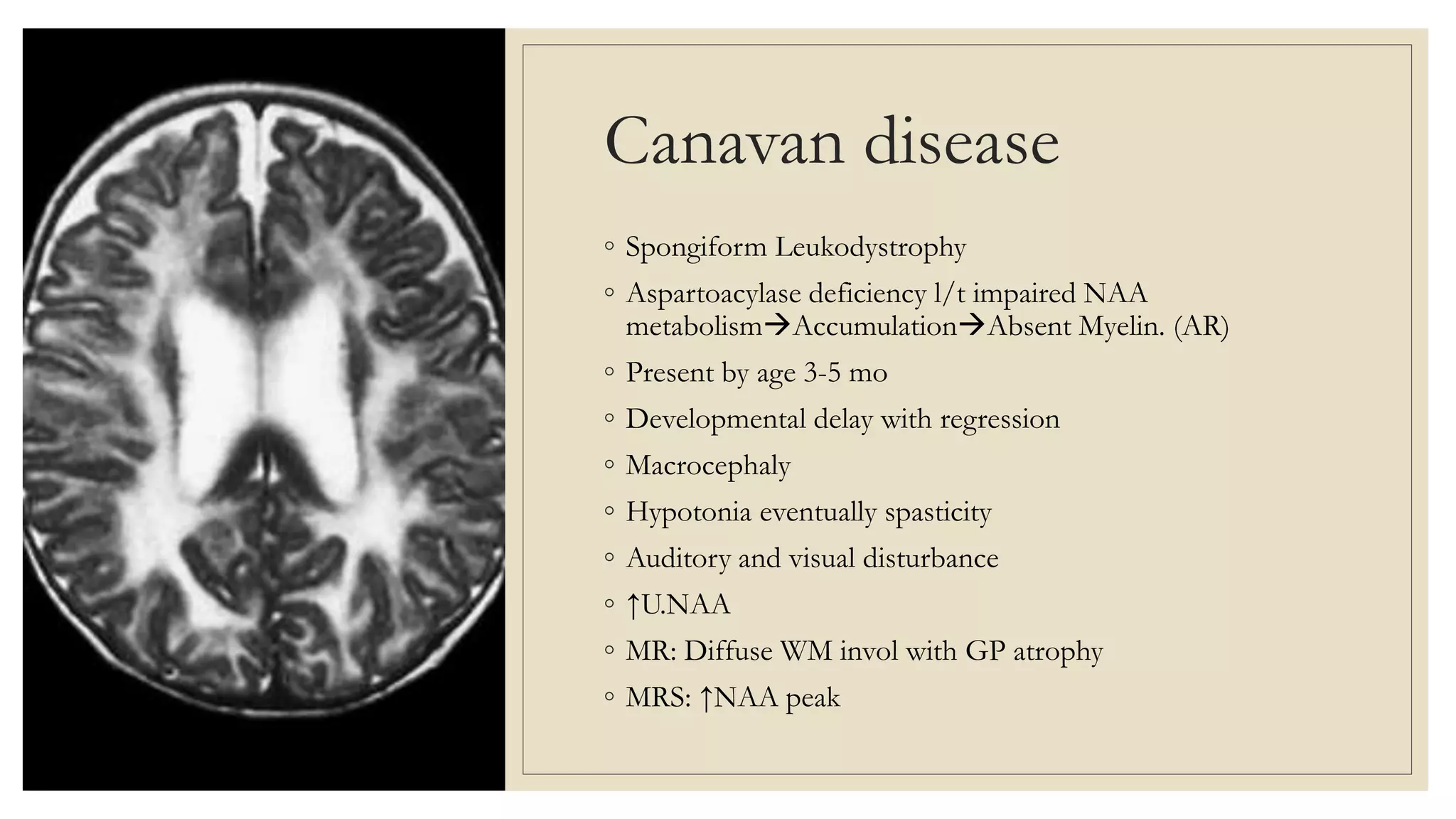 Approach to Leukodystrophy | PPTX