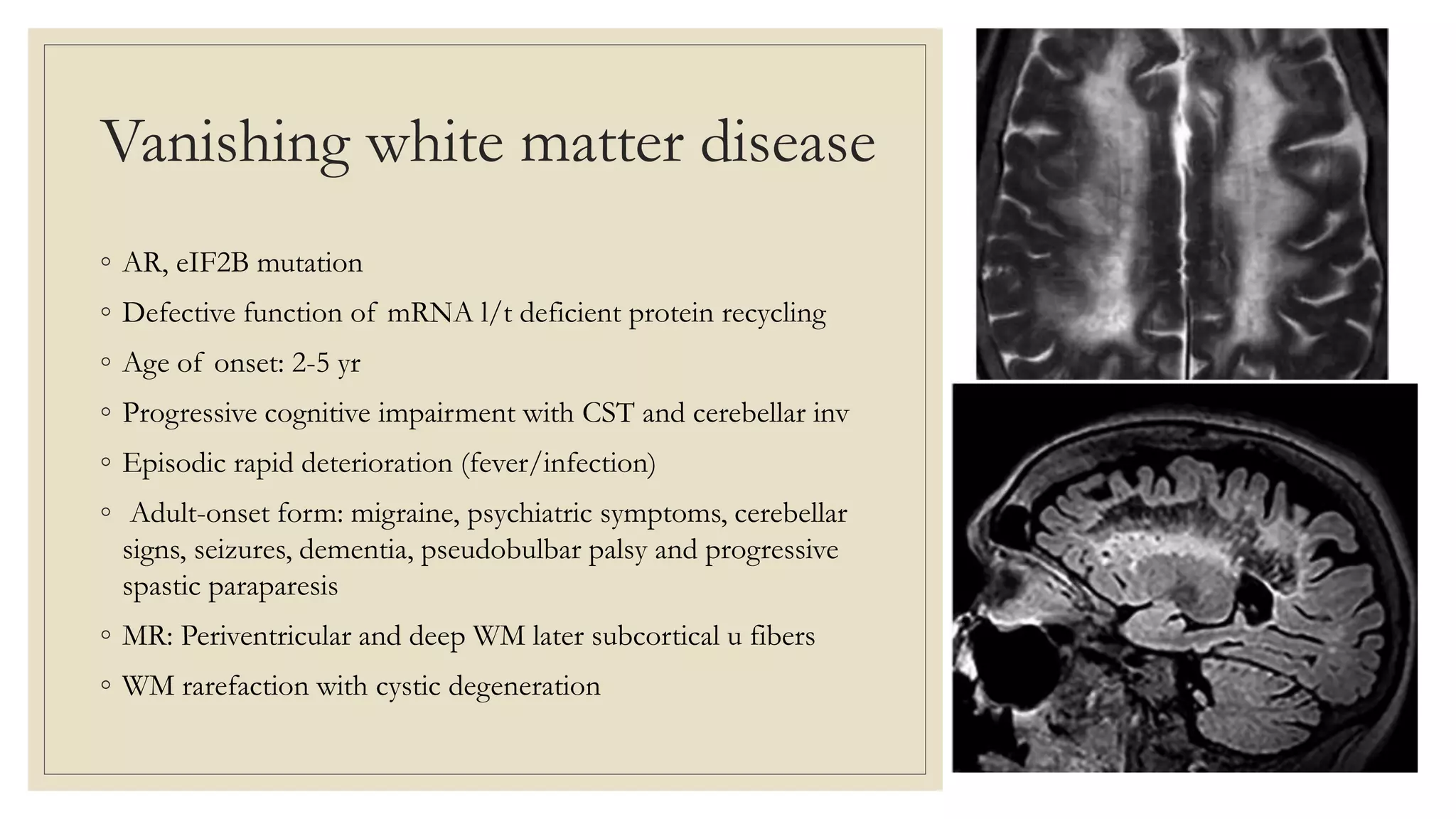 Approach to Leukodystrophy | PPTX