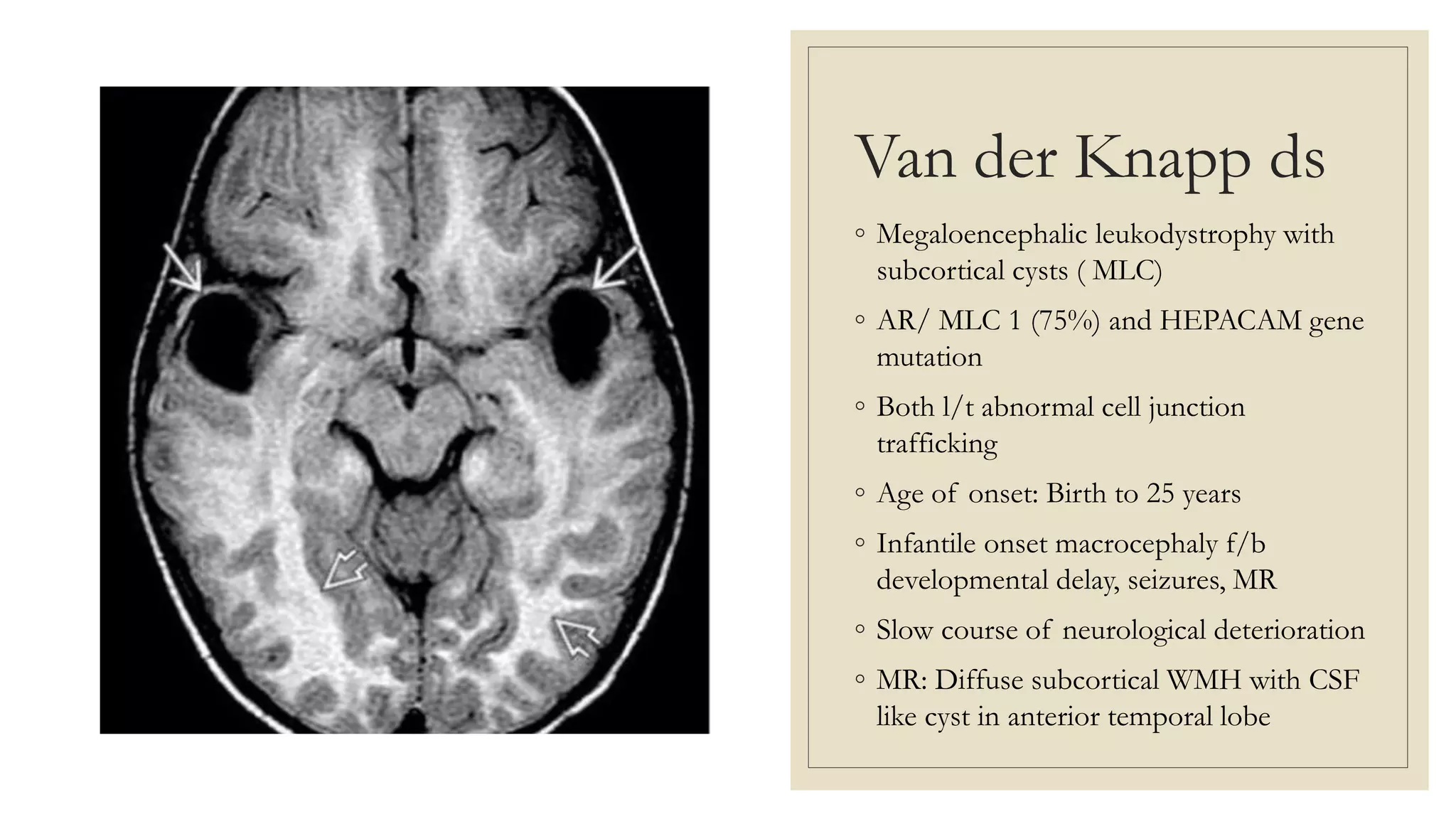 Approach to Leukodystrophy | PPTX