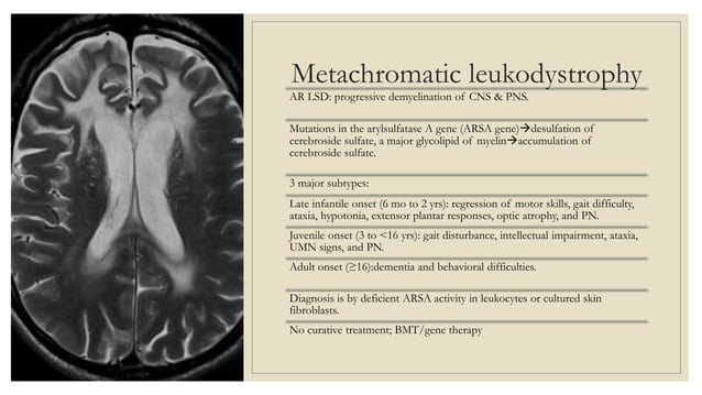 Approach to Leukodystrophy | PPTX | Brain and Nervous System Disorders ...
