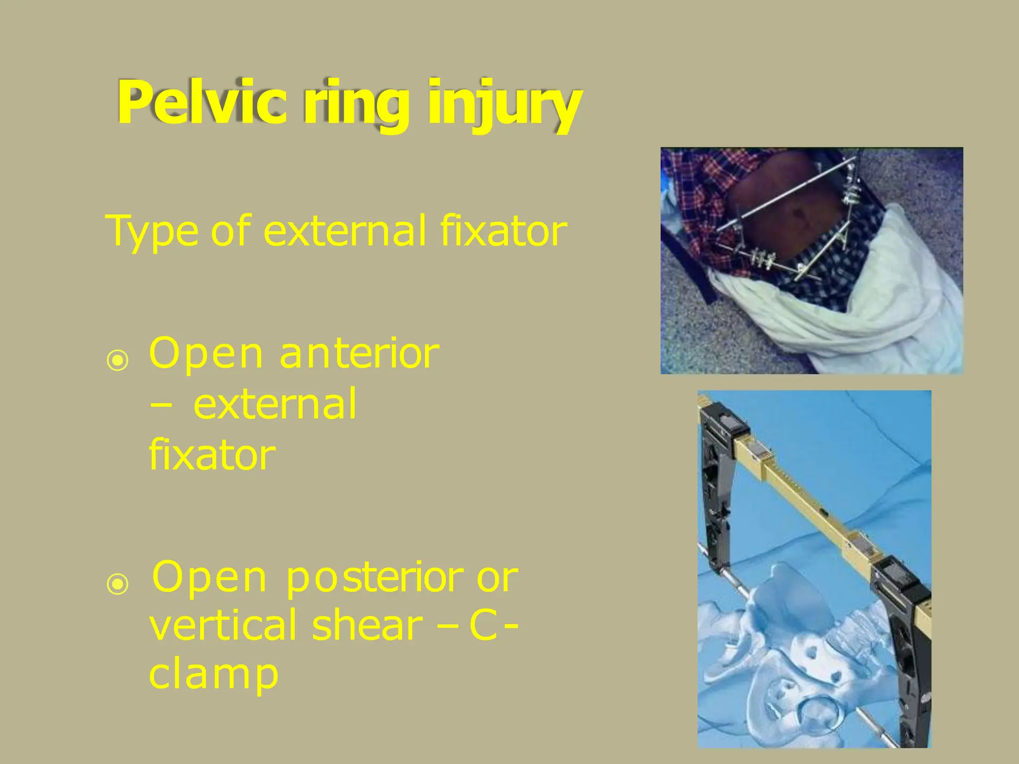 approach to limb injury post trauma atls | PPTX