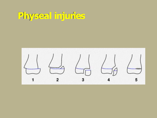 approach to limb injury post trauma atls | PPTX | First Aid | Injuries