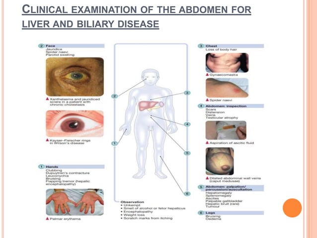 approach to liver disease.pptx | Digestive Disorders | Diseases and ...