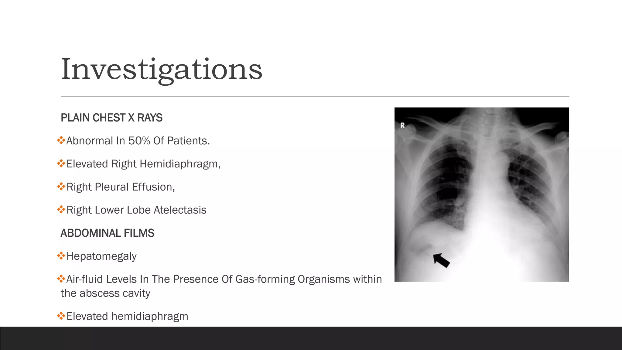 Approach to liver mass (Cystic and Solid) | PDF
