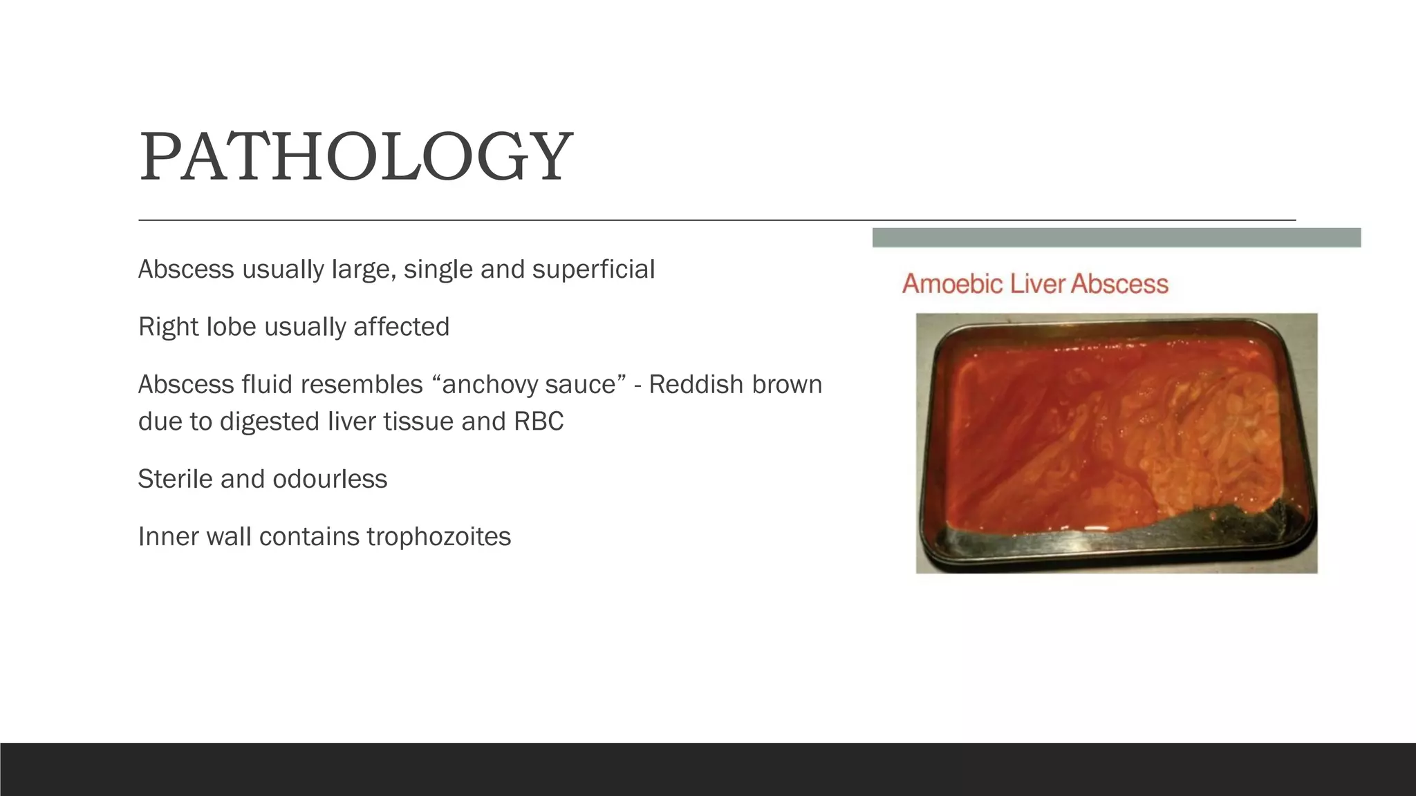 Approach to liver mass (Cystic and Solid) | PDF