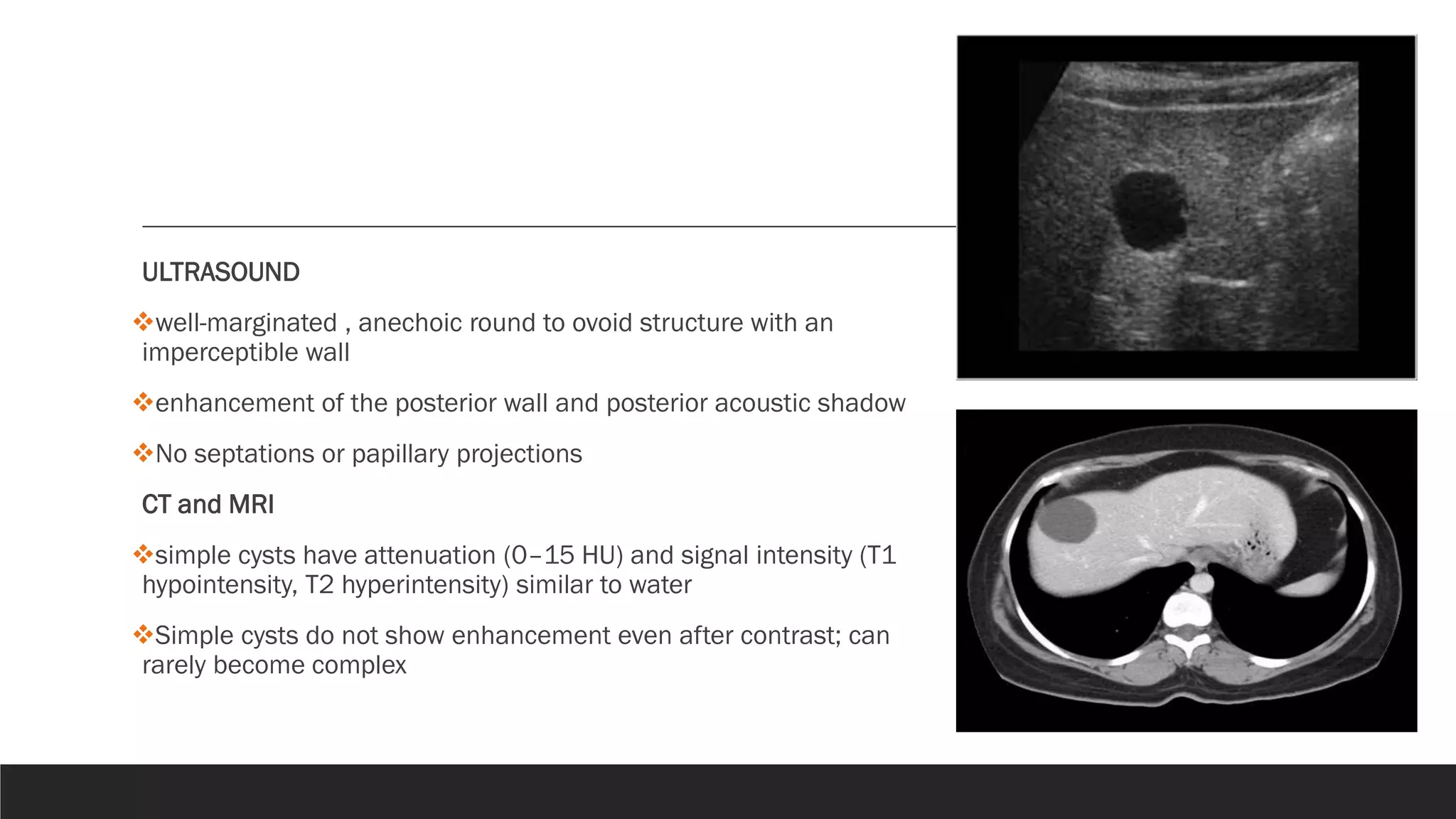 Approach to liver mass (Cystic and Solid) | PDF
