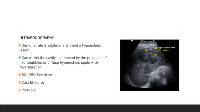 Approach to liver mass (Cystic and Solid) | PDF