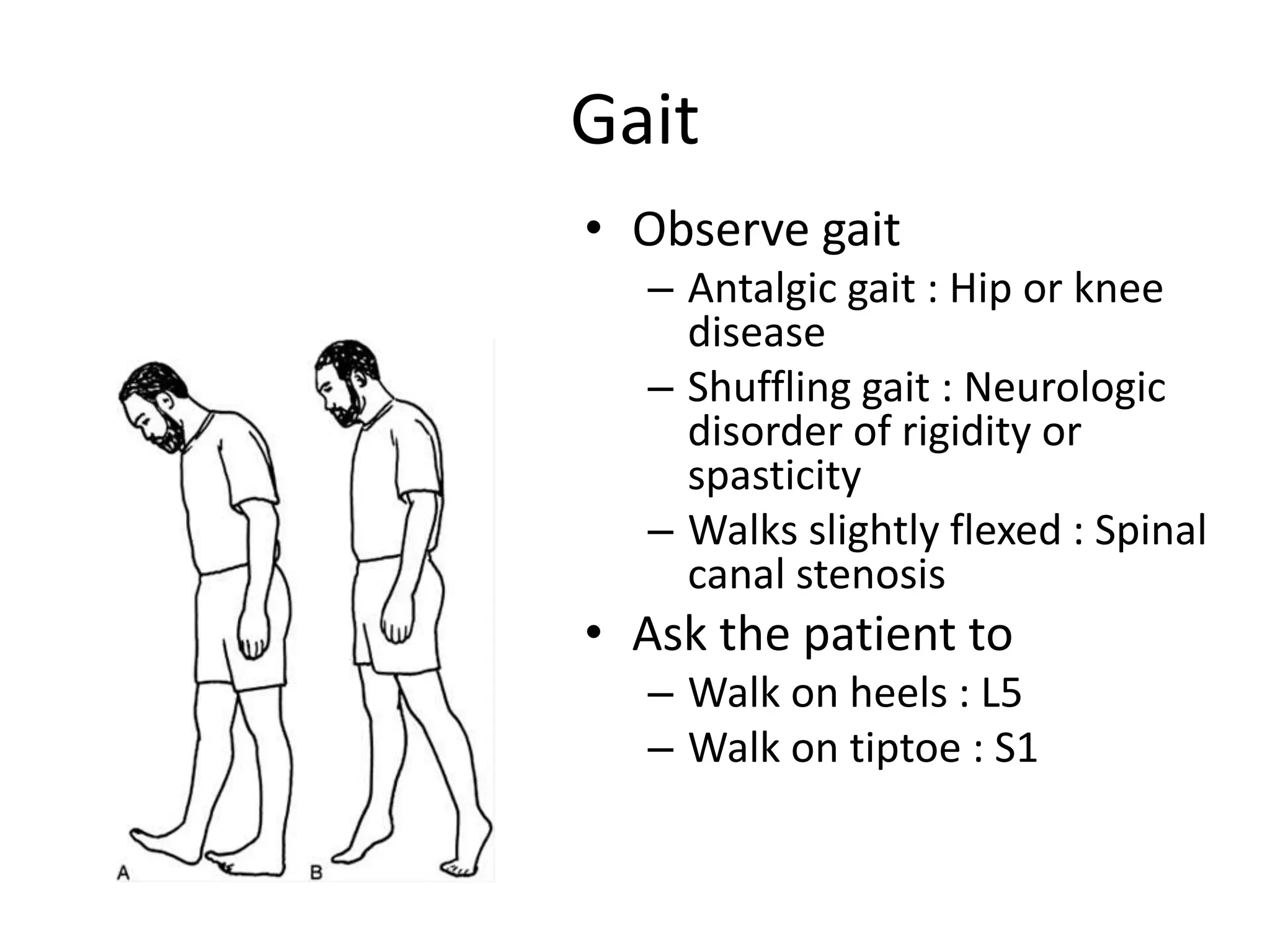 Approach to low back pain | PPTX