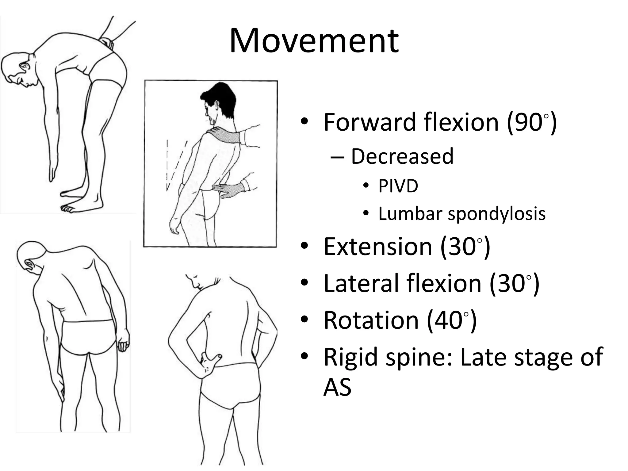 Approach to low back pain | PPTX
