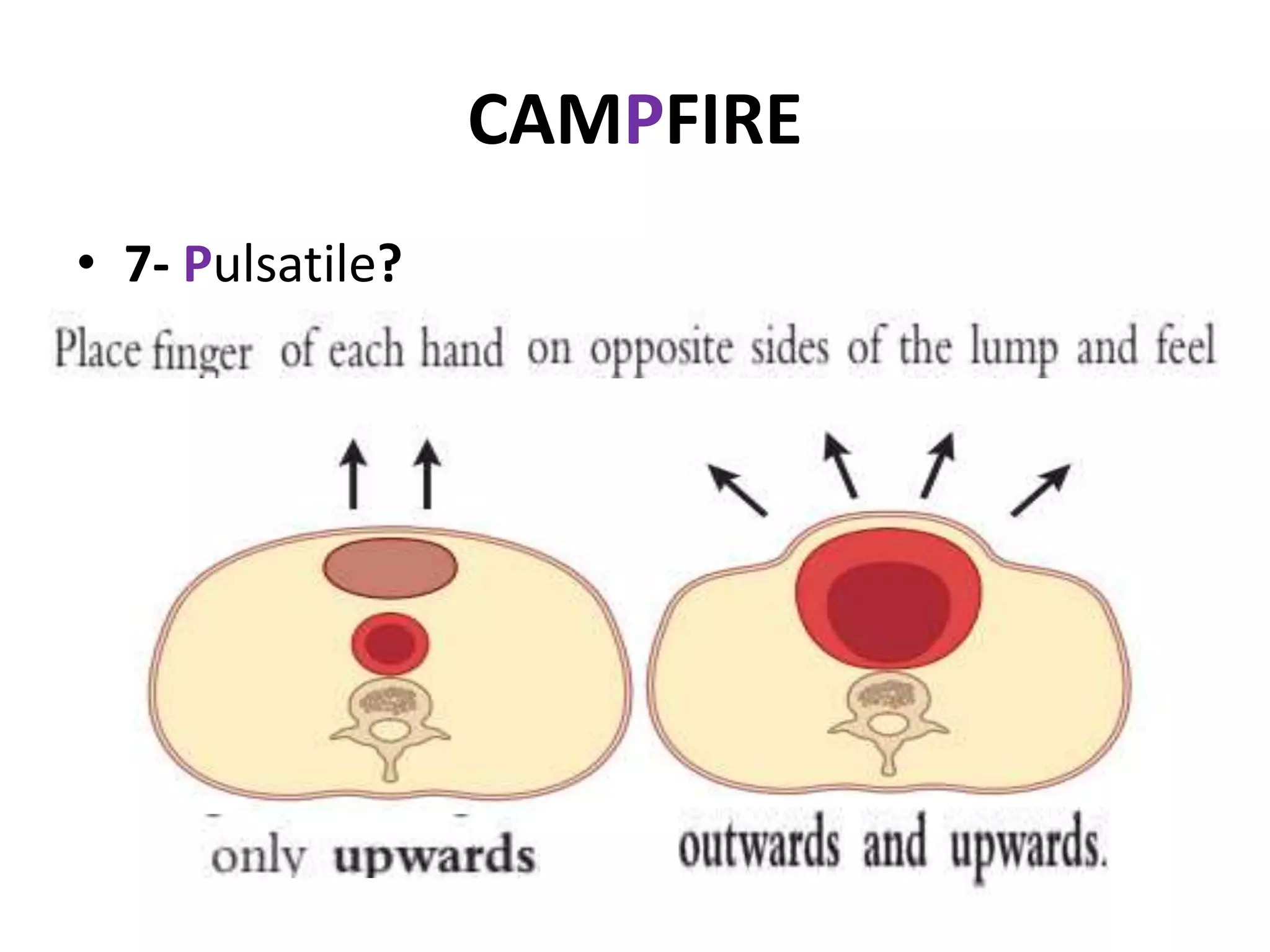 Approach to lump | PPTX