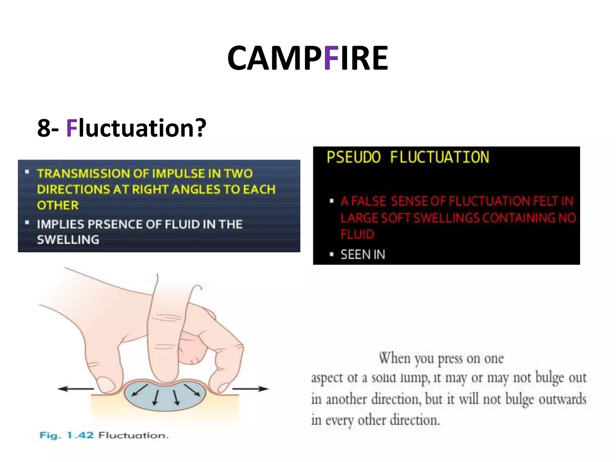Approach to lump | PPTX