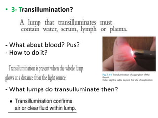 Approach to lump | PPTX