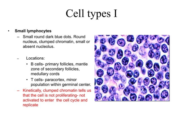 Approach to lymphnode pathology | PPTX | Infectious Diseases | Diseases ...