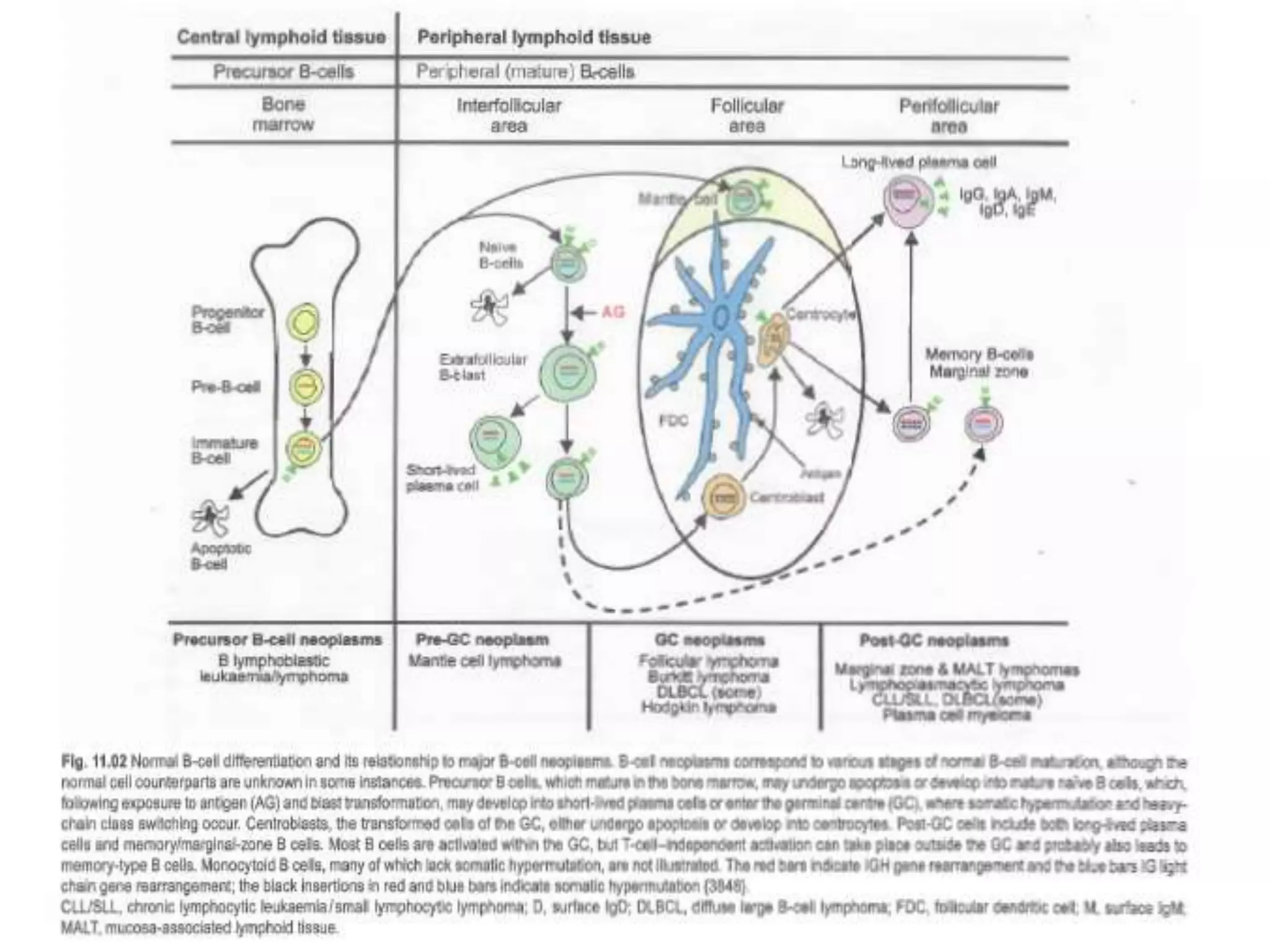 Approach to lymphoma | PPTX