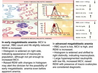 Diagnostic Approach to macrocytic anemia .pptx