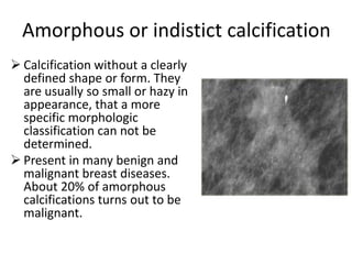 Approach to mammogram | PPTX