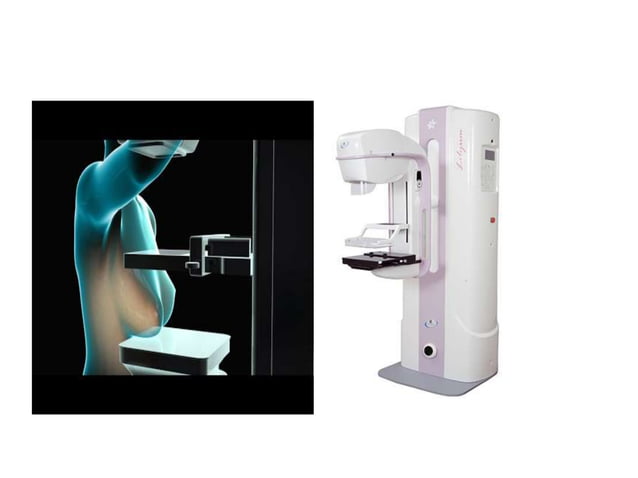 approach to mammogram.ppt