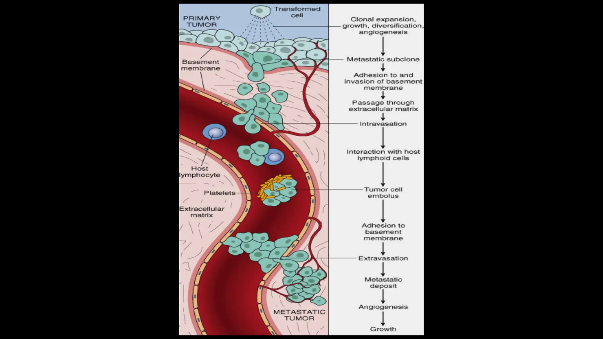 Approach to metastatic bone disease.pptx