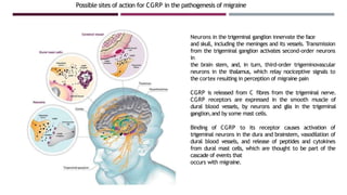 Approach to migraine diagnosis and management | PPT