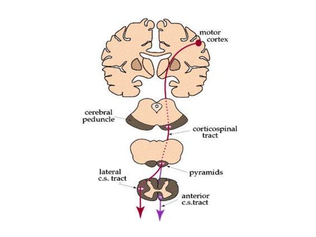 Approach to motor weakness | PPT | Death, Injury, or Military Conflict ...