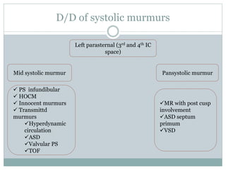 Approach to murmur | PPTX