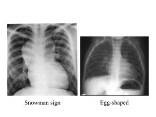 Tapvr Snowman Sign In