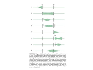 Approach to Heart Murmurs | PPTX
