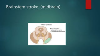 approachtomuscleweakness modified- By Sir Ghani.pptx