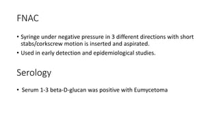 approach to mycetoma.pptx