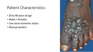 approach to mycetoma.pptx