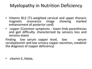 Copper Deficiency Related Myelopathy 40 Years Following A – QEID