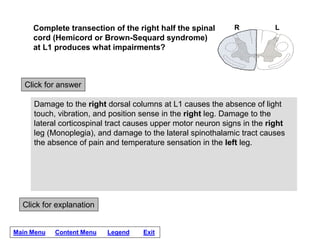 Approach to myelopathy | PPTX