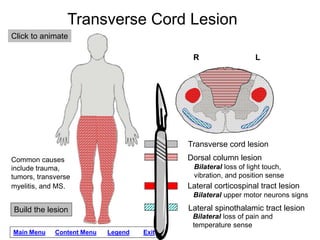 Approach to myelopathy | PPTX