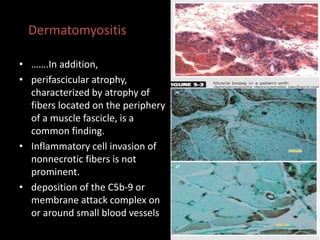 approach_to_myopathy.ppt