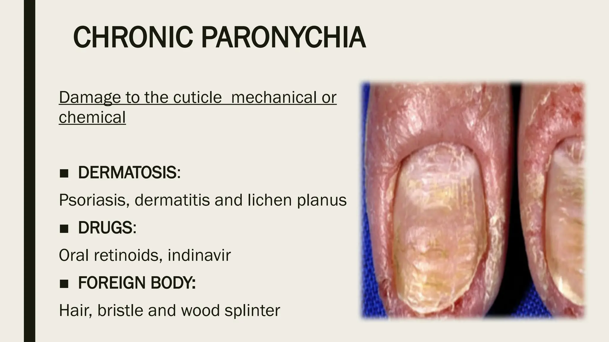 APPROACH TO NAIL DYSTROPHY FINAL..Everything about the nail.pptx