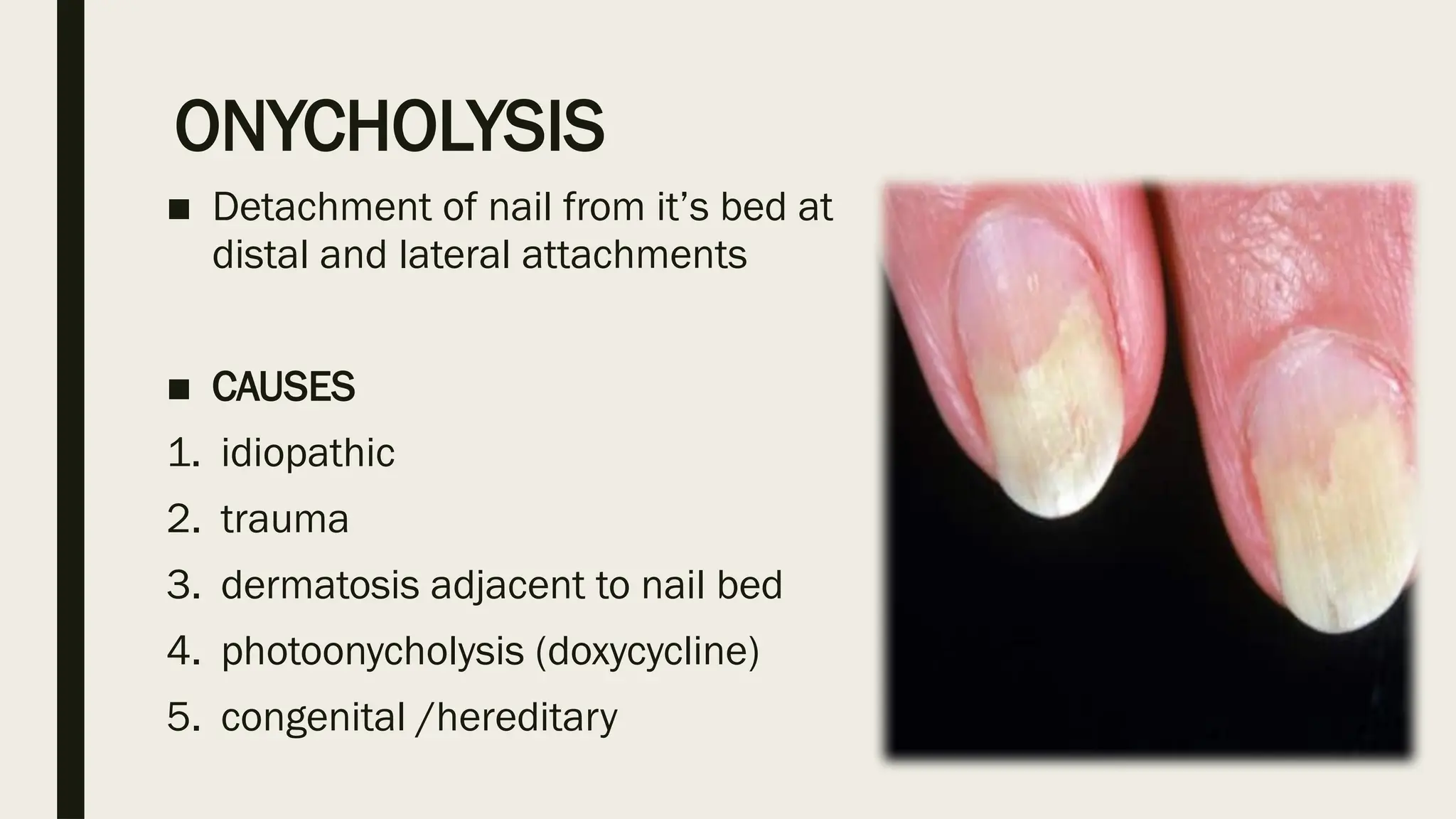 APPROACH TO NAIL DYSTROPHY FINAL..Everything about the nail.pptx