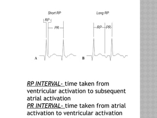 APPROACH TO NARROW COMPLEX TACHYCARDIA.pptx