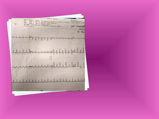 APPROACH TO NARROW COMPLEX TACHYCARDIA.pptx