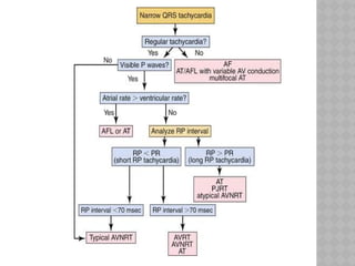 APPROACH TO NARROW COMPLEX TACHYCARDIA.pptx